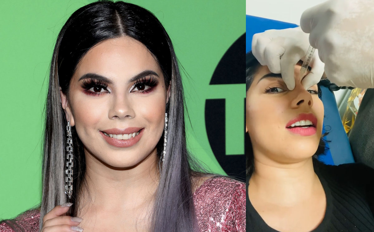 Lizbeth Rodríguez prueba tratamiento estético y cambia su rostro - Fama