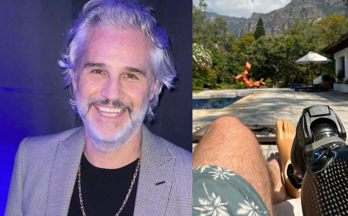 Juan Pablo Medina revela síntomas que tuvo antes de perder su pierna - Fama