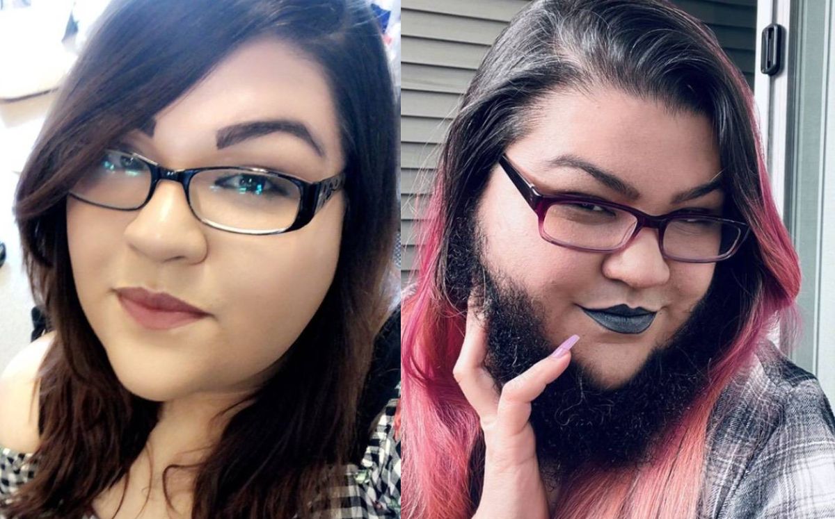 Mujer deja de afeitarse la barba y se hace viral: “Me siento hermosa ...