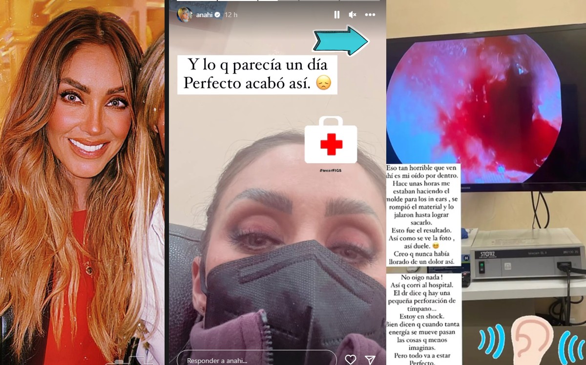 Anahí sufre accidente en prueba de sonido y se le perfora el tímpano - Fama