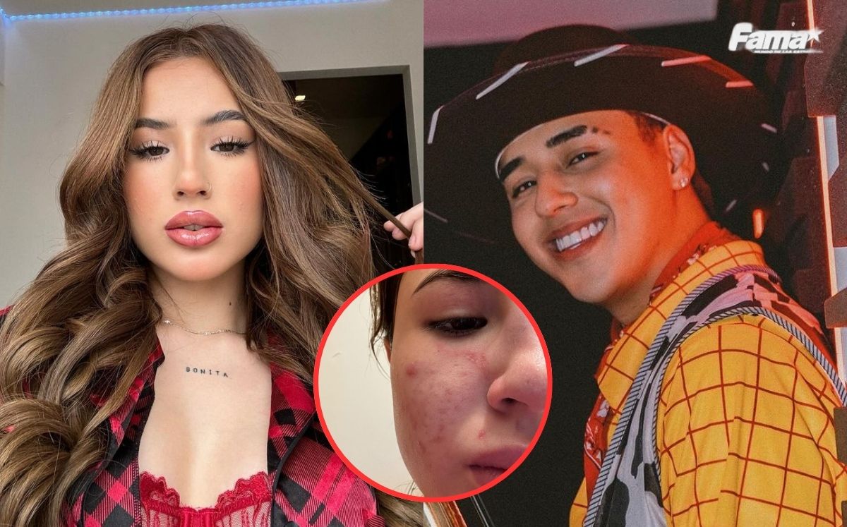 Fer Duran muestra fotos de agresiones recibidas por Lapizito - Fama