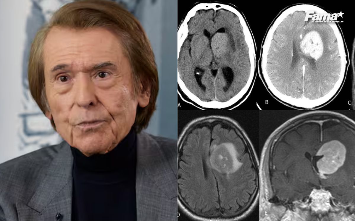 ¿qué Es Un Linfoma Cerebral Enfermedad Que Padece Raphael Fama