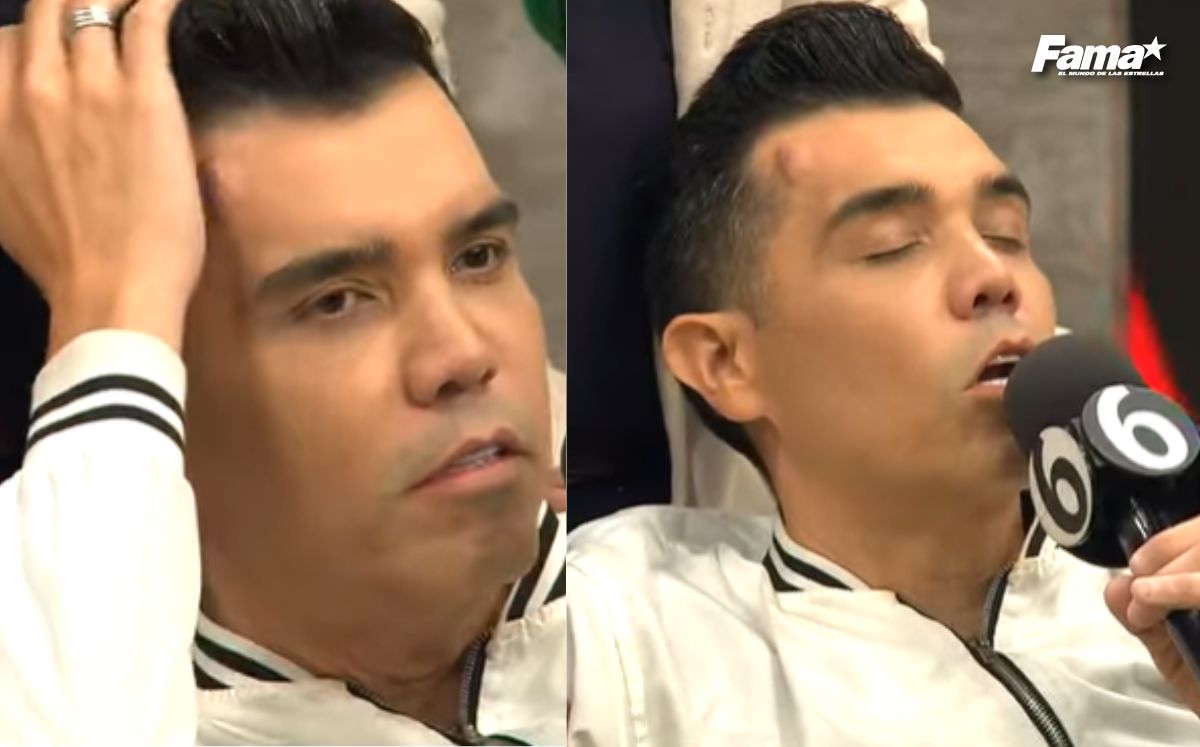 Ángel Castro sufre aparatoso golpe durante programa en vivo - Fama