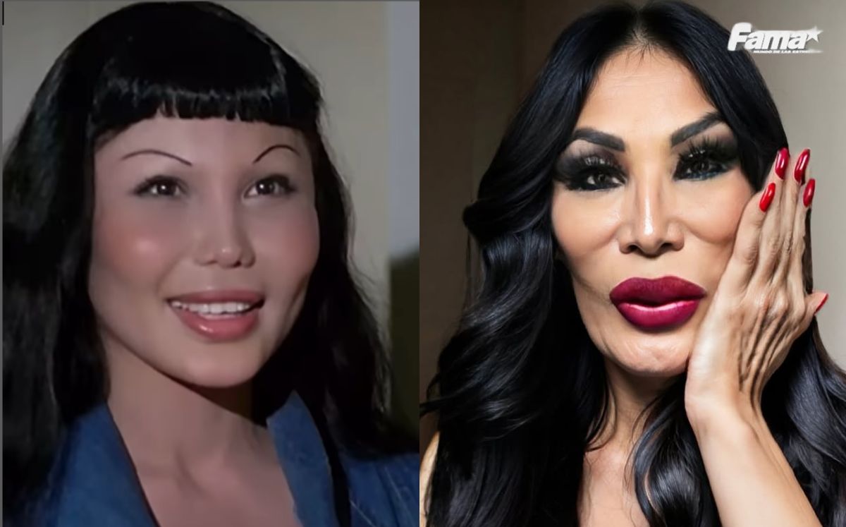 Lyn May: Antes y después de la cirugía estética que le cambio la vida ...