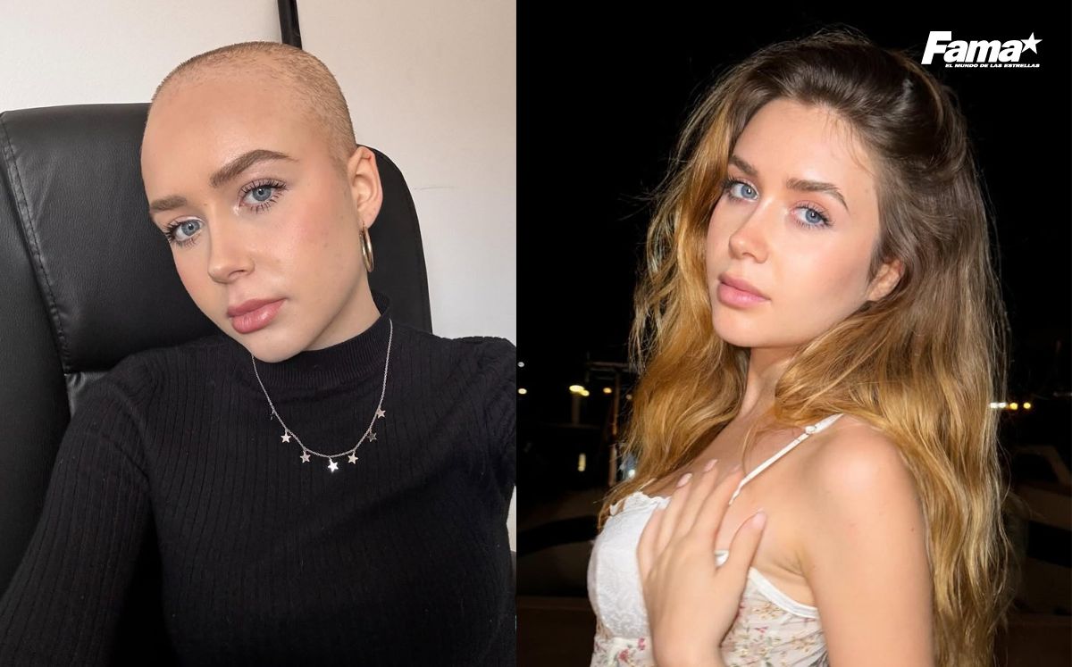 Natalia Jiménez, exparticipante de MasterChef, se rapa ante cáncer - Fama