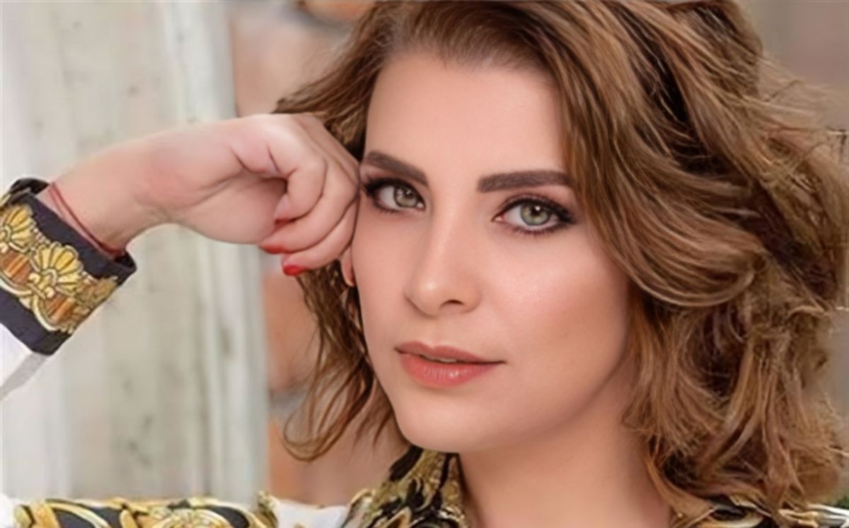 Lisset cae en una coladera en CDMX y resulta con graves heridas - Fama