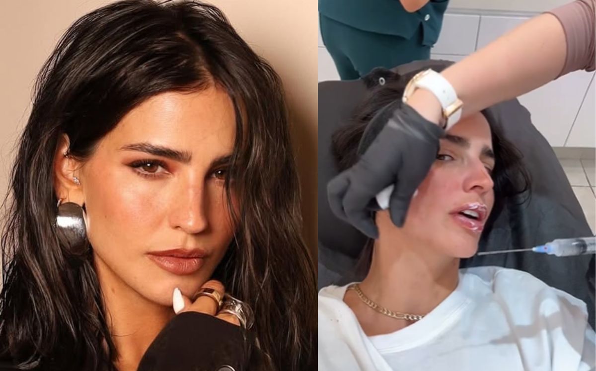 Bárbara de Regil se somete a tratamiento estético para rejuvenecer - Fama