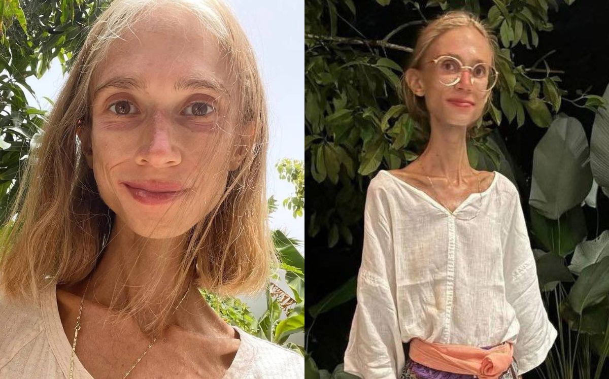 Muere con 27 años Karolina Kryzak, la mujer que sólo comía fruta cruda ...