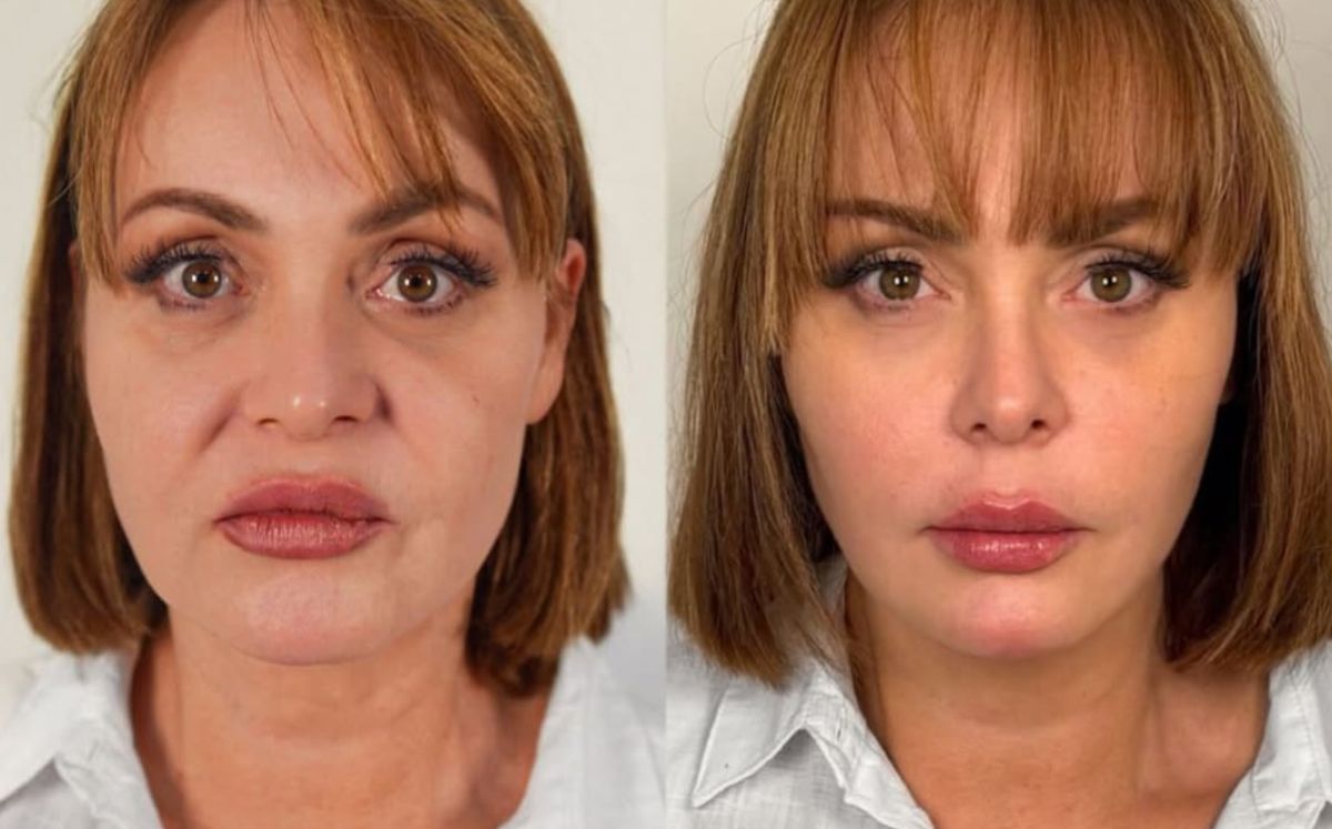 Gaby Spanic sorprende con drástico cambio en el rostro; así luce ahoraFama