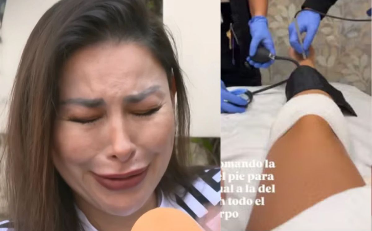 Gaby Ramírez revela su estado de salud tras ser atacada por un perroFama