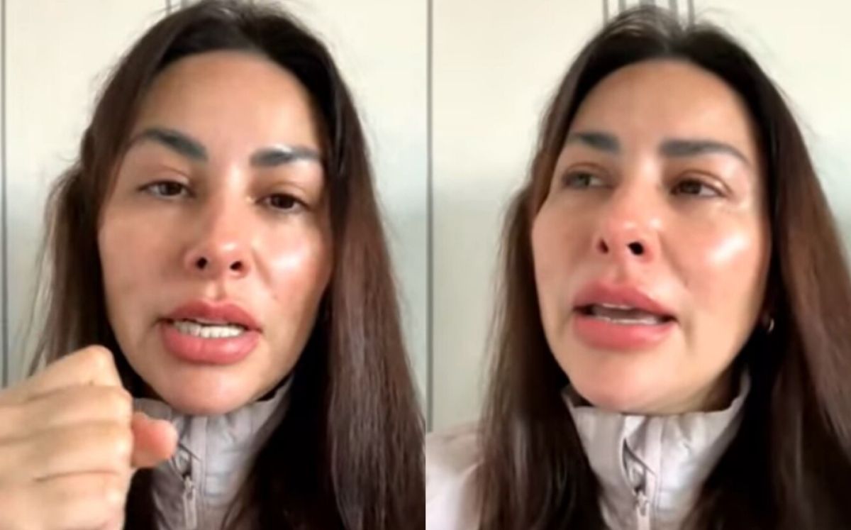 Gaby Ramírez muestra la mordida de perro que le destrozó la piernaFama